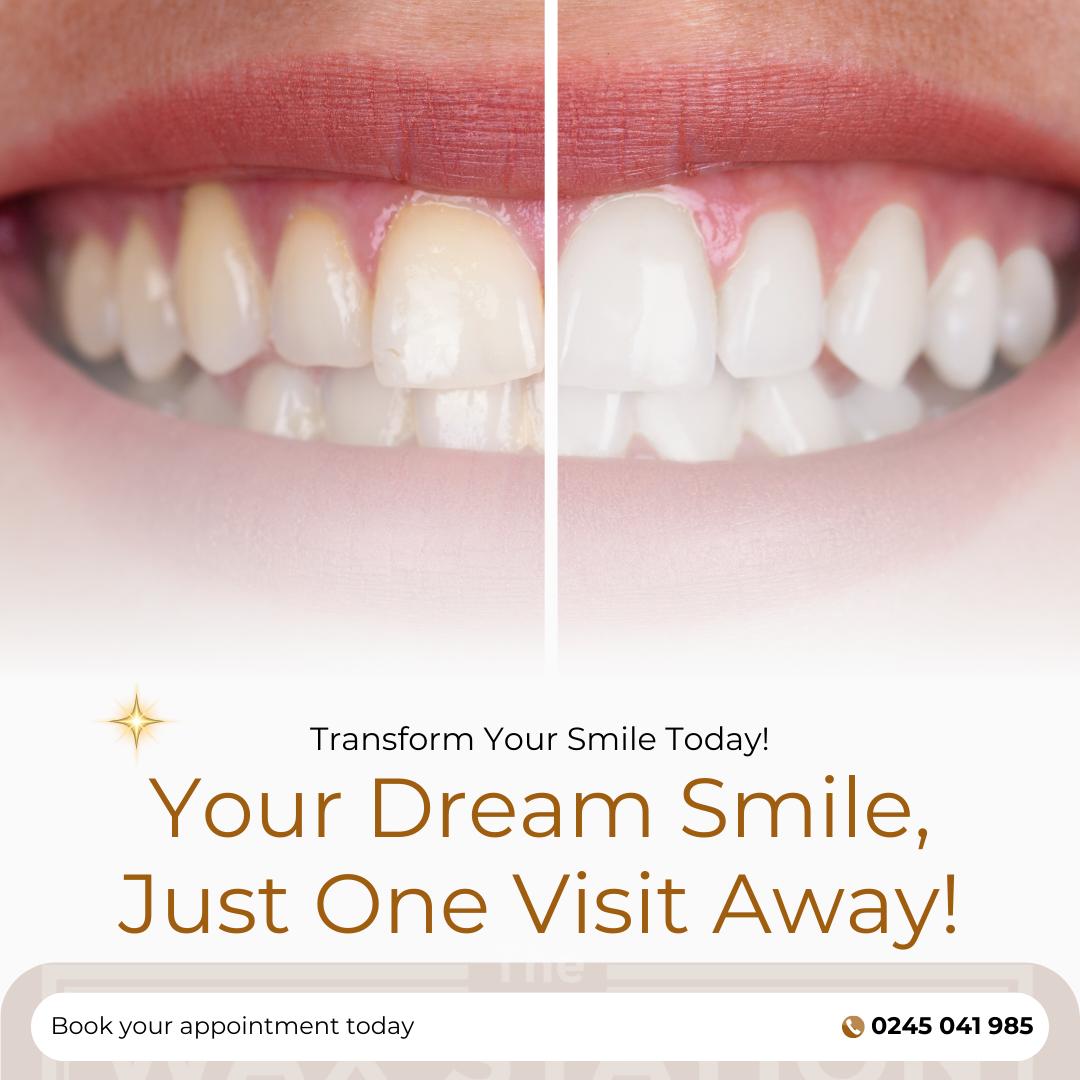 Why a Whiter Smile Feels So Good – Teeth Whitening – The Wax Station